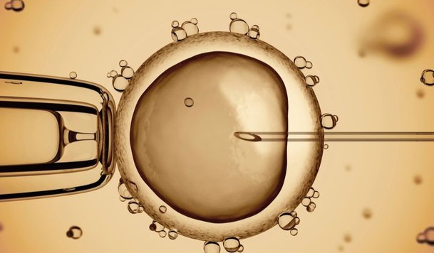 Gamete Intrafallopian Transfer (GIFT)